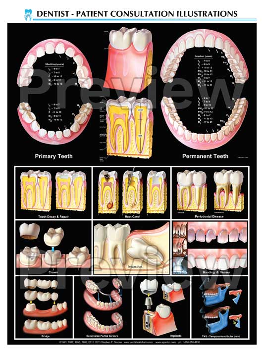 Dental Overview Wall Chart – Dental Flip Charts by Stephen F. Gordon